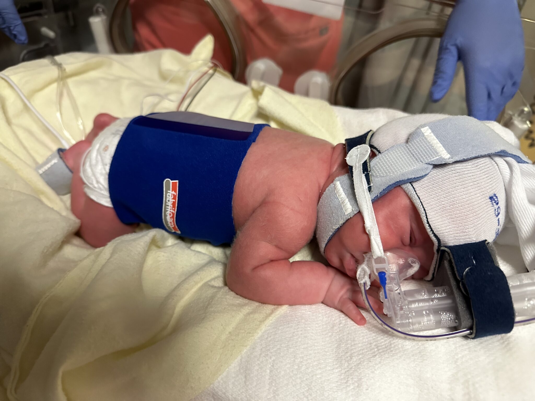 NICU Miracles - Innovia Foundation